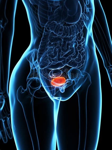 A Diseased Bladder Stock Illustration Illustration Of Anatomy 141766296