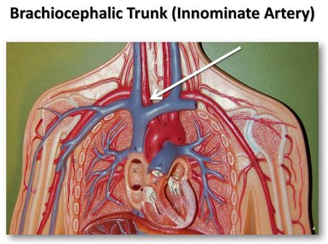 Brachiocephalic Trunk The Anatomy Of The Arteries Visual Guide Page