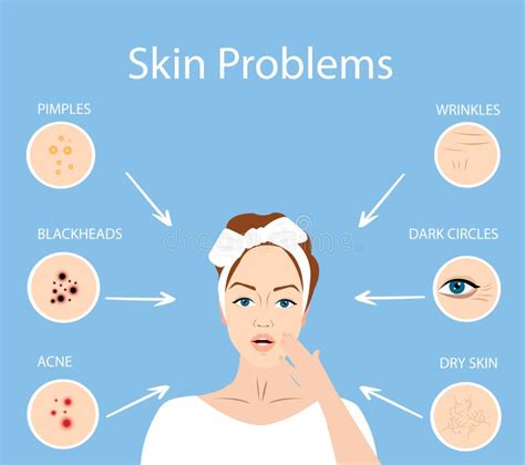 Vector Of A Woman With Face Skin Problems Stock Illustration