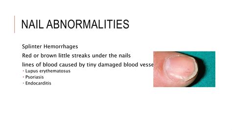 Nail Abnormalities Pptx