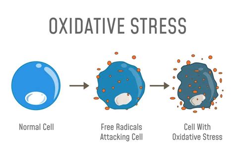 Oxidative Stress Vector Art Stock Images Depositphotos