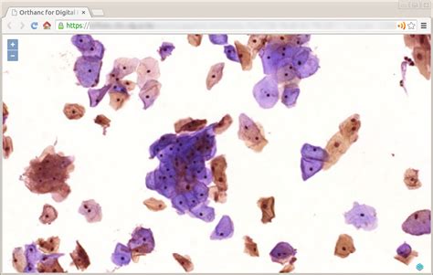 Dicom Mimedical Imaging Favourite Things