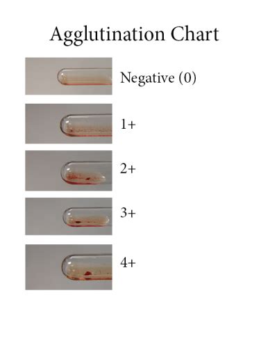 Lab 4 Agglutination And Serial Dilution Flashcards Quizlet