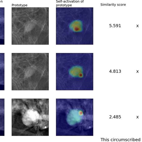 An Automatically Generated Explanation Of Mass Margin Classification