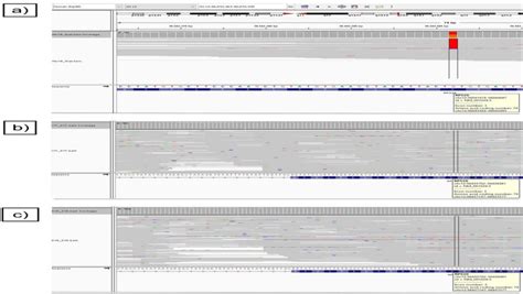 A Novel Nonsense Rps26 Mutation In A Patient With Diamond Blackfan