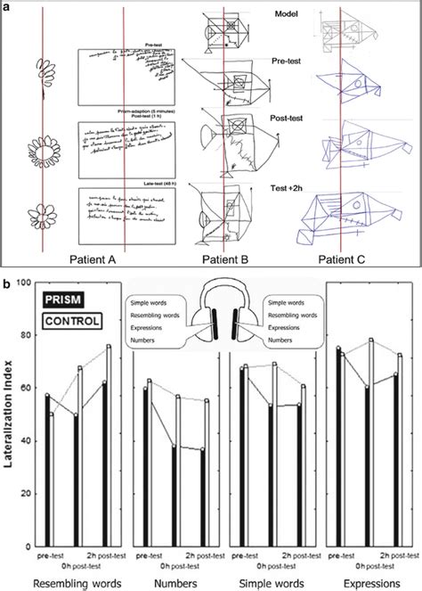 Testing Cognition And Rehabilitation In Unilateral Neglect With Wedge Prism Adaptation Multiple