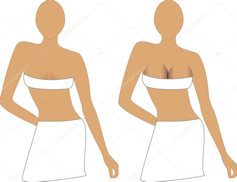 Breast Implants — Stock Vector © Basheeradesigns 2500547