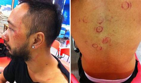 Hong Kong Outrage After Police Beat Handcuffed Pro Democracy