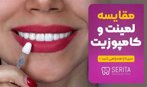 فرق لمینت و کامپوزیت دندان چیست؟ مقایسه کامل کلینیک سریتا