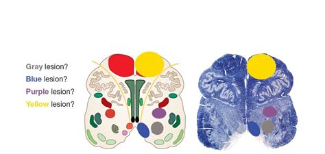 Neuroanatomy Unit 2 Diagram Quizlet
