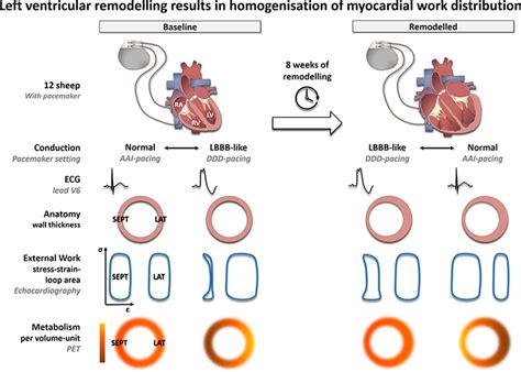 Left Ventricular Remodeling Results In Homogenization Of Myocardial