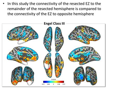 Ppt Resting State Fmri Analysis As A Predictor Of The Success Of
