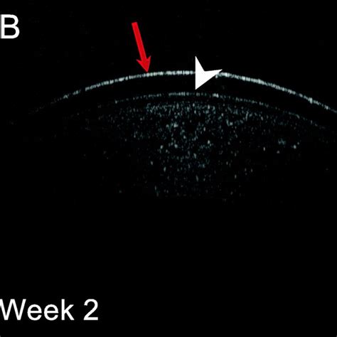 Representative As Oct Imaging Of Cornea Photographs From One Ocular