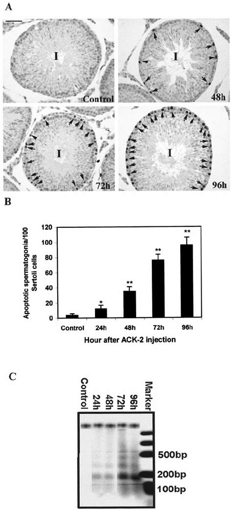 Spermatogonial Apoptosis Induced By Blocking SCF C Kit Interaction By
