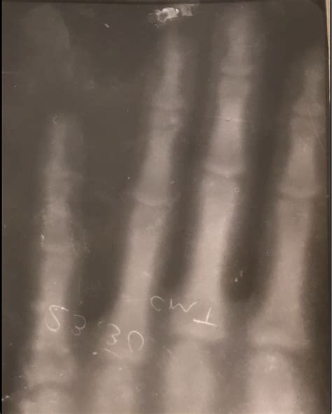 Tesla S Single Wire Shadowgraph Recreated G G Brock Laboratories