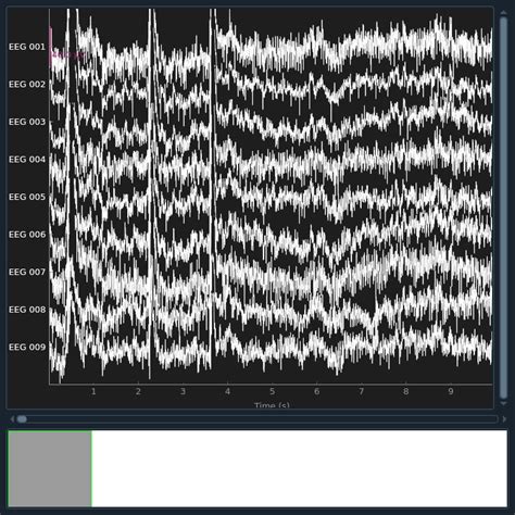Repairing Artifacts With Ica Automatically Using Iclabel Model — Mne