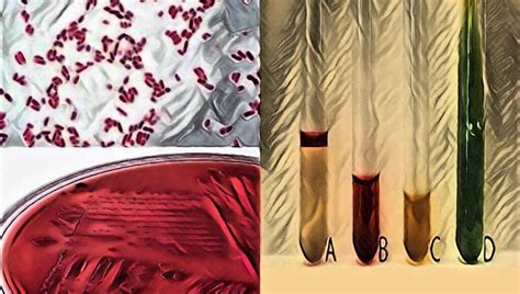 Check Out The Various Biochemical Tests For Escherichia Coli Li