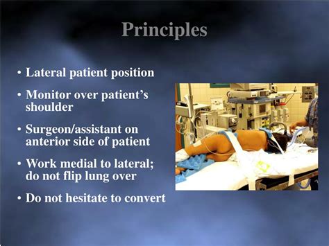 Ppt Thoracoscopic Lobectomy Powerpoint Presentation Free Download