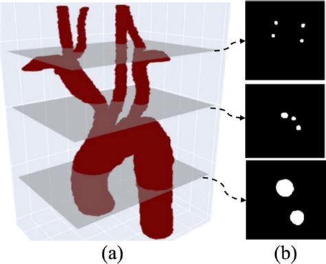논문 리뷰 Pi Att Topology Attention For Segmentation Networks Through Adaptive Persistence Image