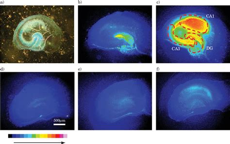 Figure 1 From The Use Of Organotypic Hippocampal Slice Cultures To