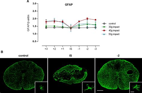 Expression Of Gfap Considered As A Highly Specific Marker Of Download Scientific Diagram