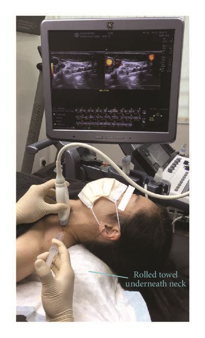 Procedure For Cervical Nerve Root Hydrodissection Patient Positioning