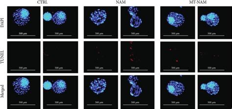 Dna Fragmentation Analysis After Nam Treatment In The Presence And