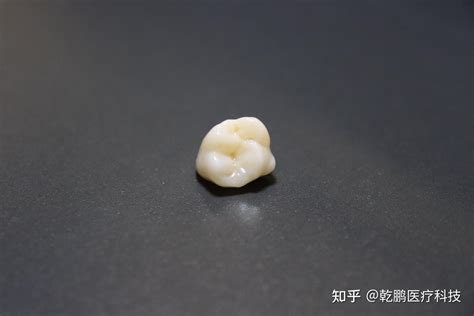 常见的全瓷牙种类有哪些？ 知乎