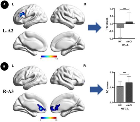 Altered Anterior Cingulate Cortex Subregional Connectivity Associated With Cognitions For