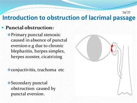 Suraj Lacrimal Appartus Ppt 2 Suraj Lacrimal Appartus Ppt 2