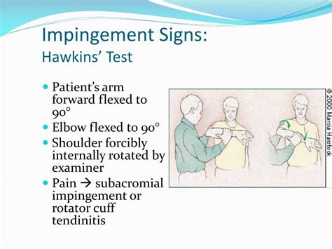 Ppt The Shoulder Evaluation And Treatment Of Common Injuries