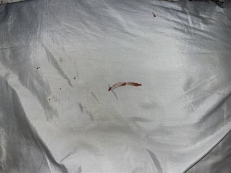 Bed Bug Blood Stain Rbedbugs