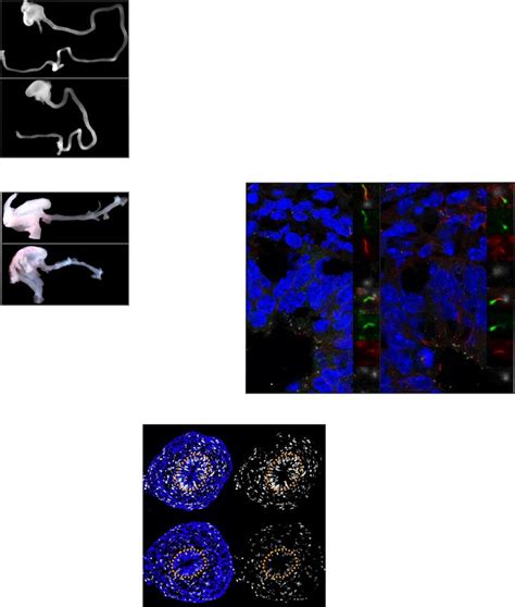 Ciliary Hedgehog Signaling Patterns The Digestive System To Generate