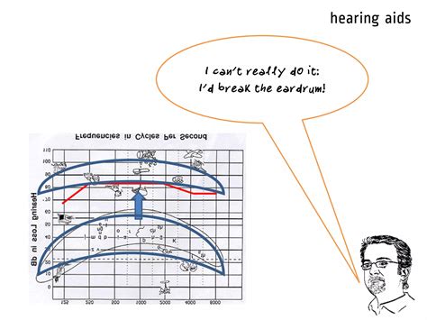 Audiogram Hearing Aids Cochlear Implant Rev Ppt