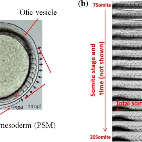 A A Zebrafish Embryo At 11 Somites Stage Notice The Precursor Of The