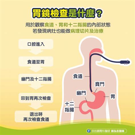 什麼情況下需要照胃鏡？醫親揭：黑便、體重減輕⋯「這6症狀」就要照uho優活健康網