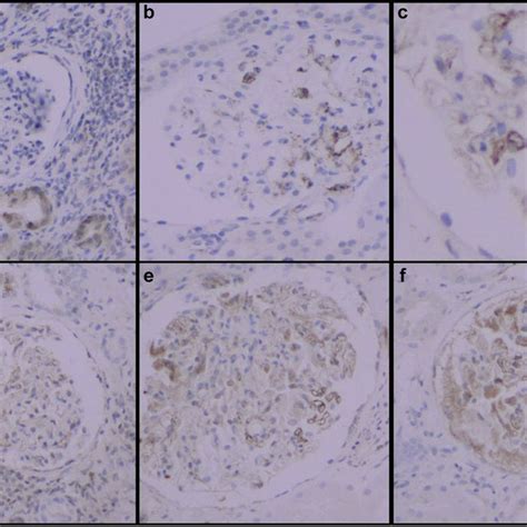 Spectrum Of C4d Glom Immunohistochemistry A Normal Glomerulus Download Scientific Diagram