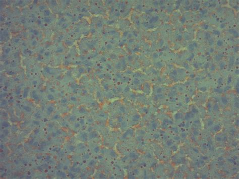 Liver Lipids Oil Red O Staining Method Researchgate