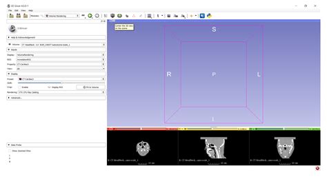Crop24 Forensic Craniofacial Identification