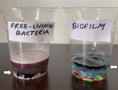 Distribution Of The Antibiotic Food Coloring Through The Two