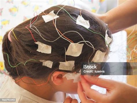 의료 검사를 위해 머리에 부착 된 Eeg 전극을 가진 소녀 뇌전도에 대한 스톡 사진 및 기타 이미지 뇌전도 아이