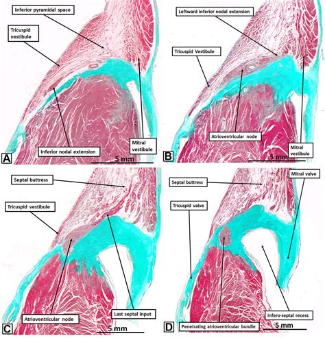 Atrioventricular Node