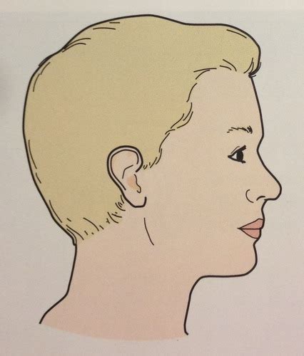 Classification Of Malocclusion Flashcards Quizlet