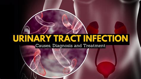 Urinary Tract Infection Treatment Causes At Timothy Beck Blog