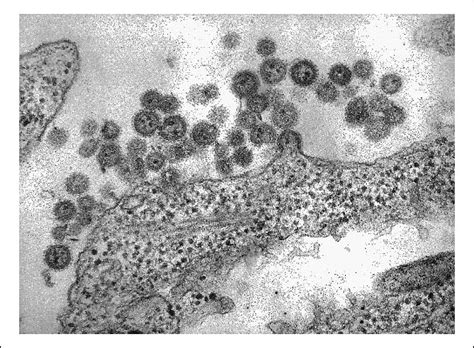 Virus Machupo Fiebre Hemorrágica Boliviana Fundación Io