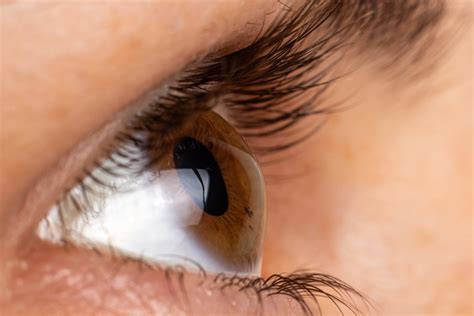 What Is World Keratoconus Day Swagel Wootton Eye Institute