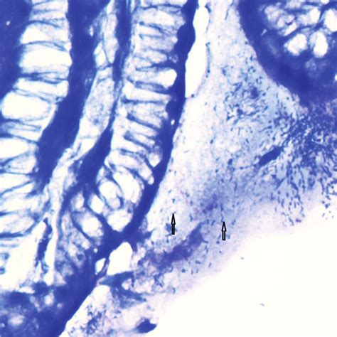 Picture Depicting Hpe Of Modified 2 Giemsa Staining 1000x Showing Hp