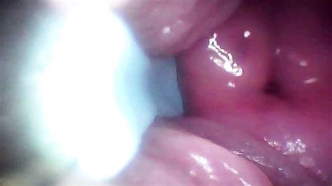 Recorded Close Up Of A Womans G Spot The Camera Probe Goes Deep Into