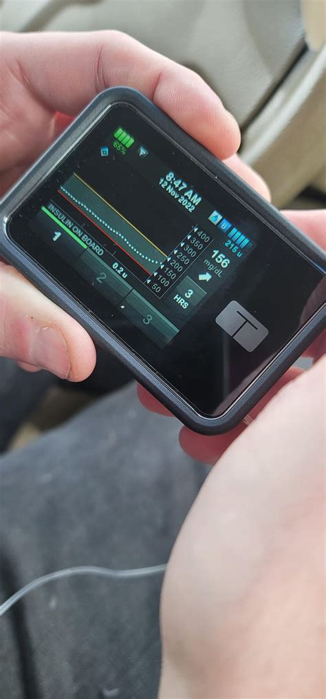 Not Able To Successfully Accept An Invitation In The Follow App R Dexcom