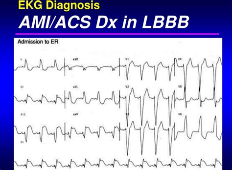Ppt Amiacs Diagnosis History And Physical Powerpoint Presentation
